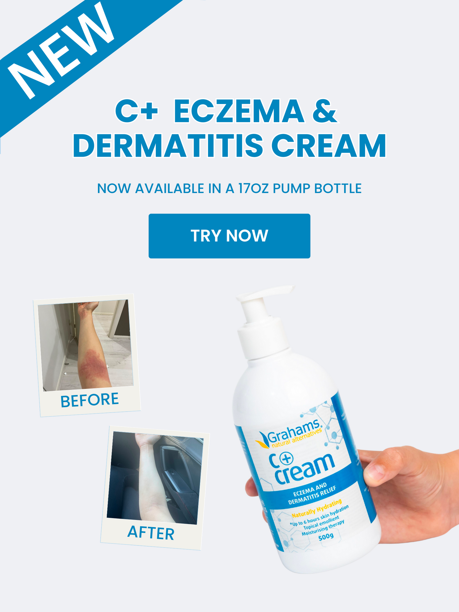 Grahams Natural Eczema Cream | Eczema, Psoriasis & Rosacea – Grahams ...