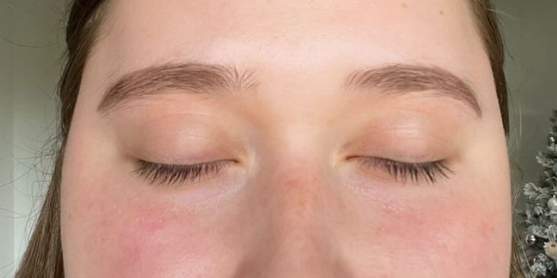 Grahams Natural Eczema Cream | Eczema, Psoriasis & Rosacea – Grahams ...